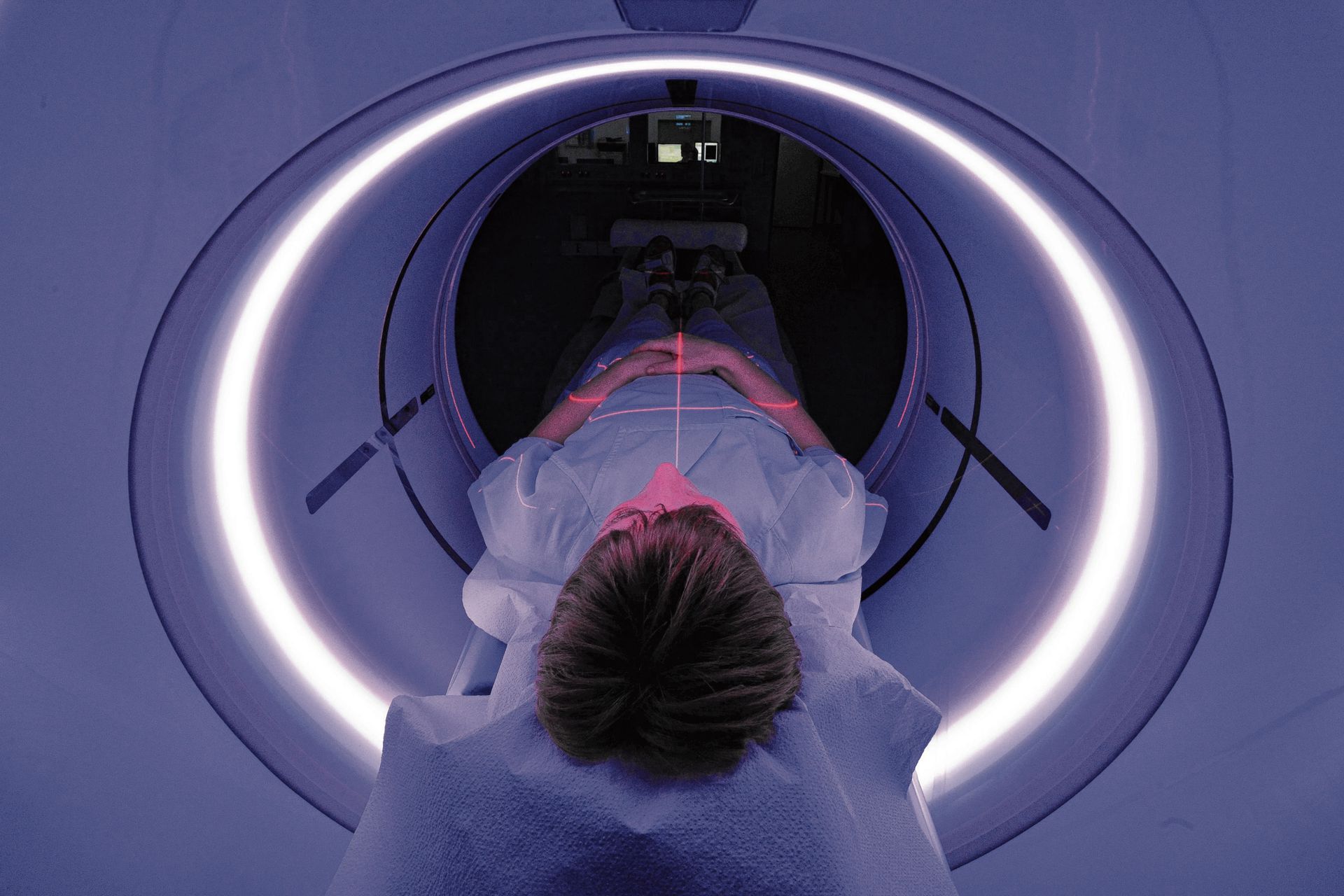 Nooit meer wachten op het beeld van een CT-scan - NRC