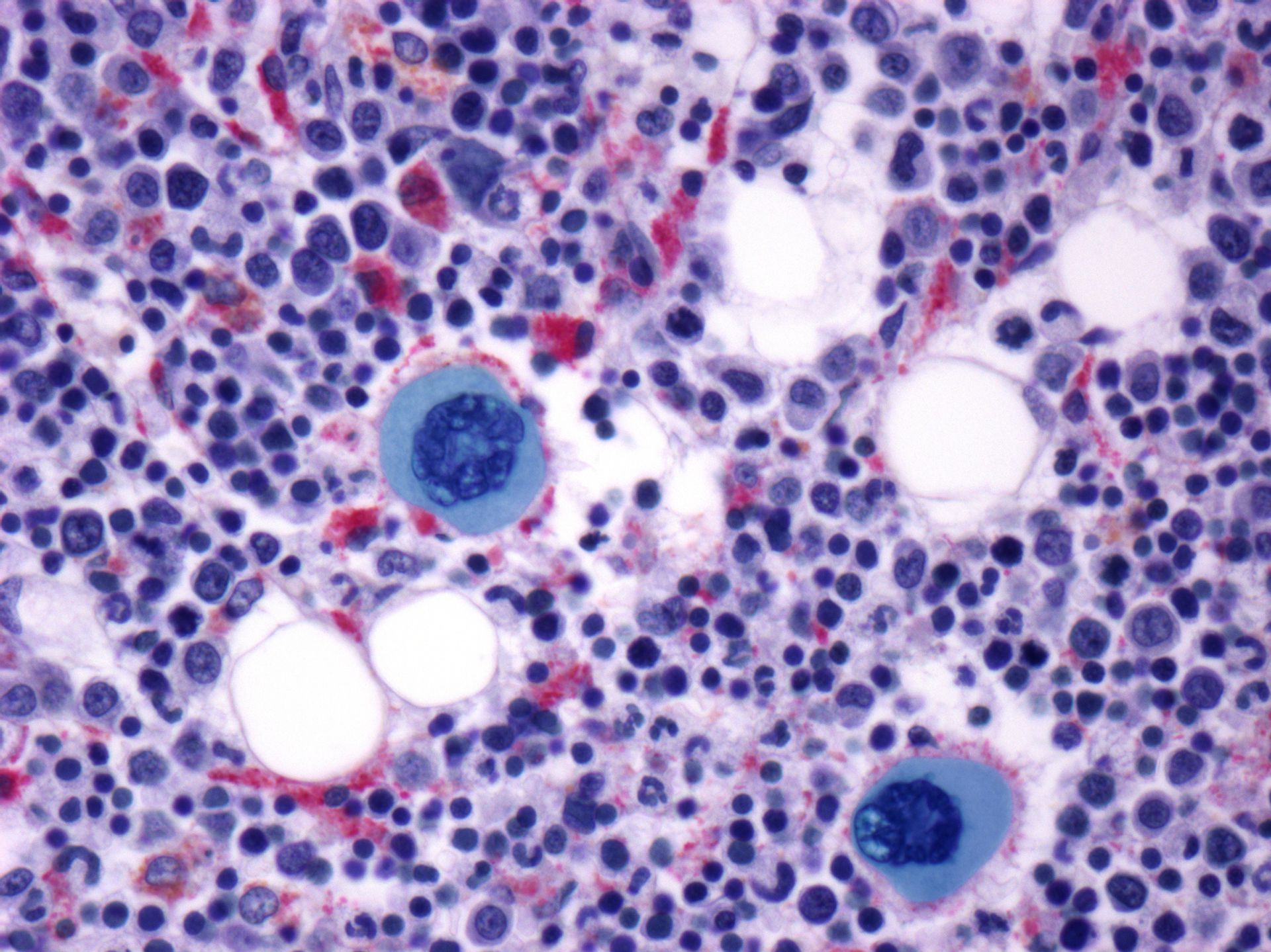 Bloedstamcellen hebben eigen niche in beenmerg - NRC