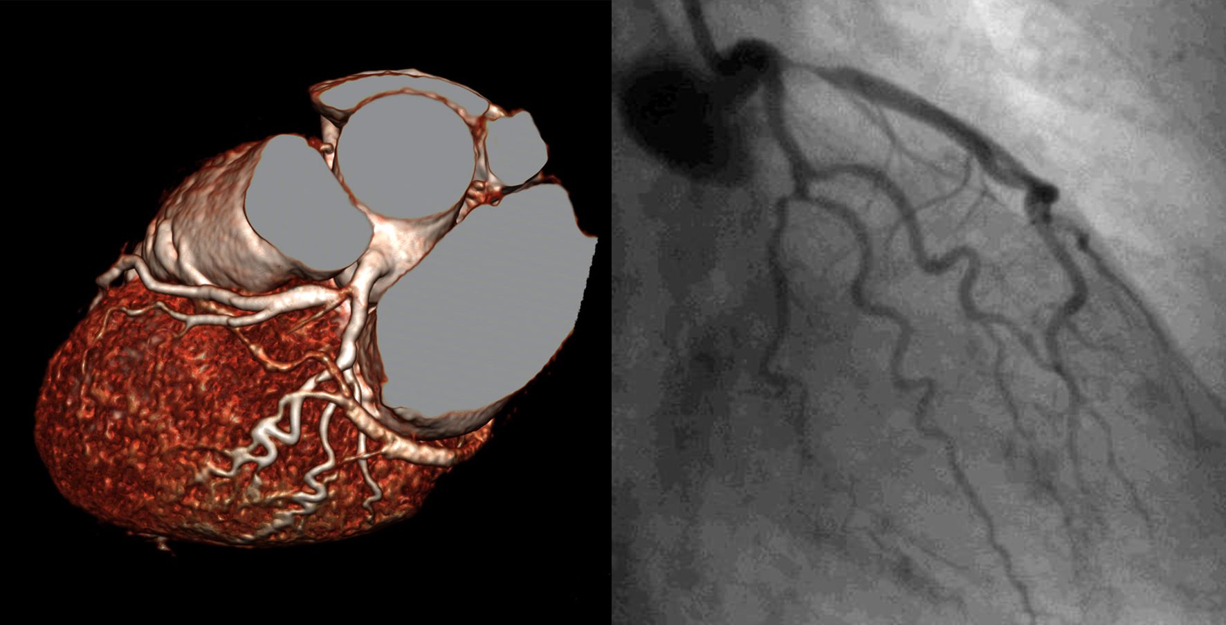 Vernauwd beeld - NRC