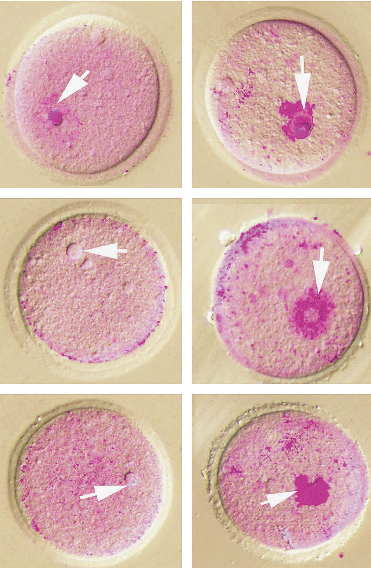 Bij vrouwen boven 35 verouderen eicellen snel door niet-herstelde DNA ...