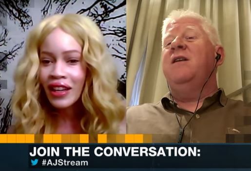 In gesprek met albino’s over stigma’s en stereotypes - NRC