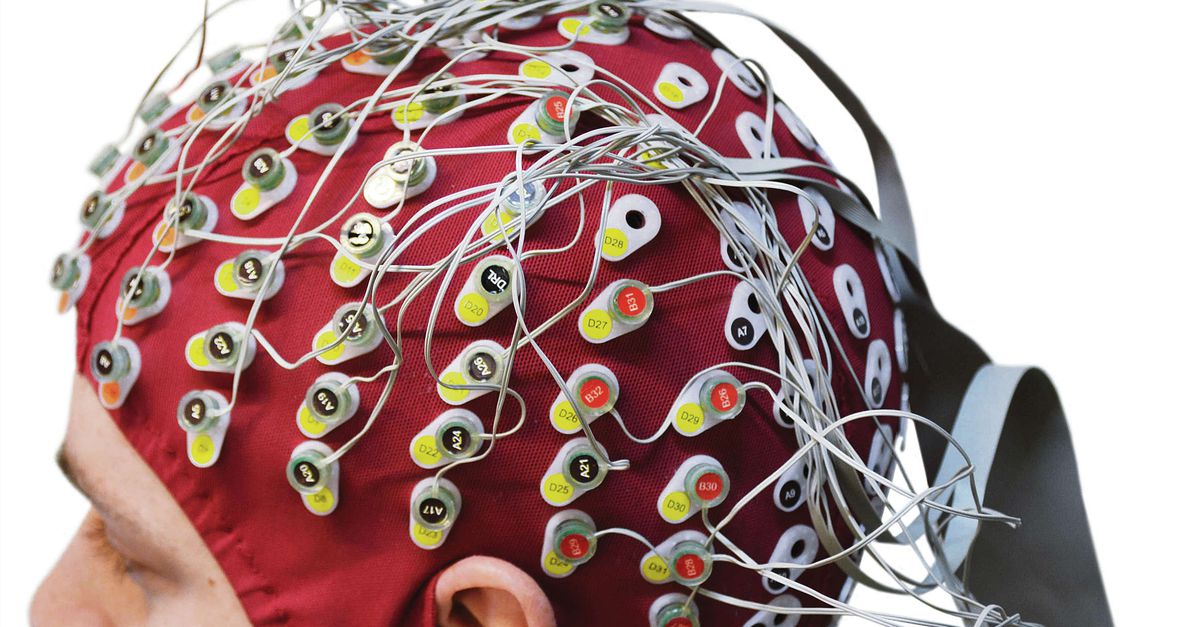 ADHD? Leg uw kind maar in de scanner - NRC