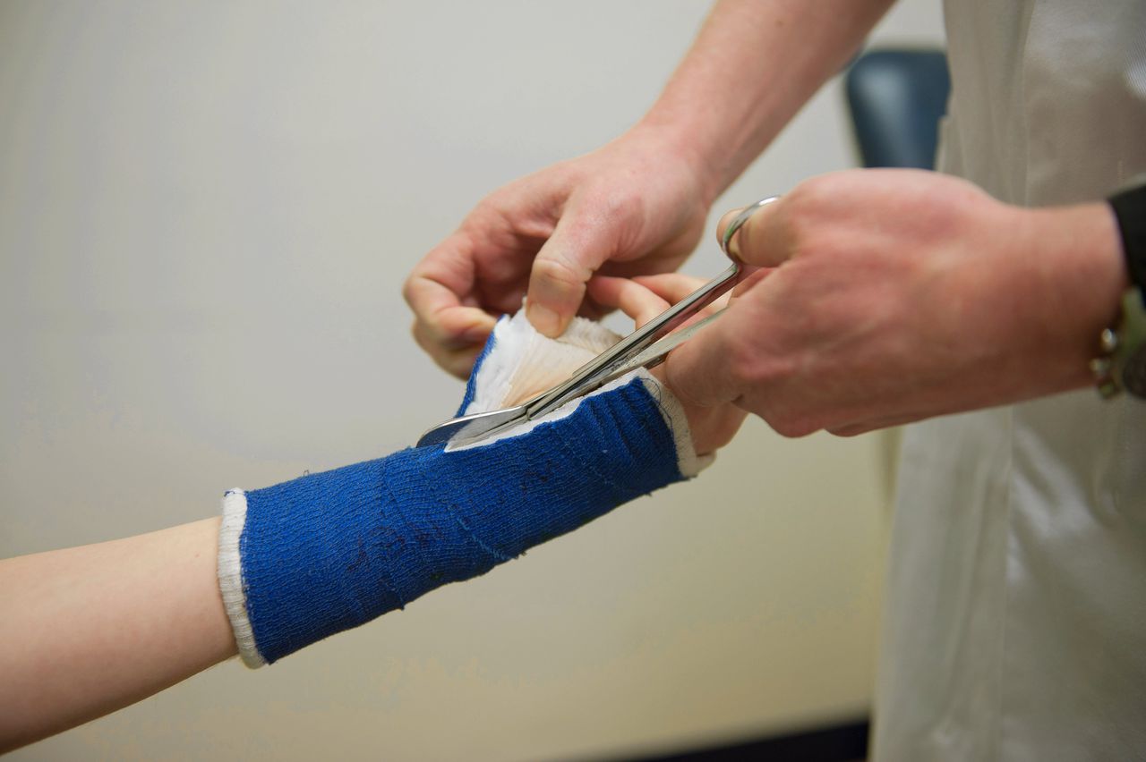 Waar komen die dikke haren vandaan op een gipsarm? - NRC