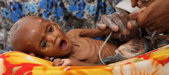 Honger In Afrika