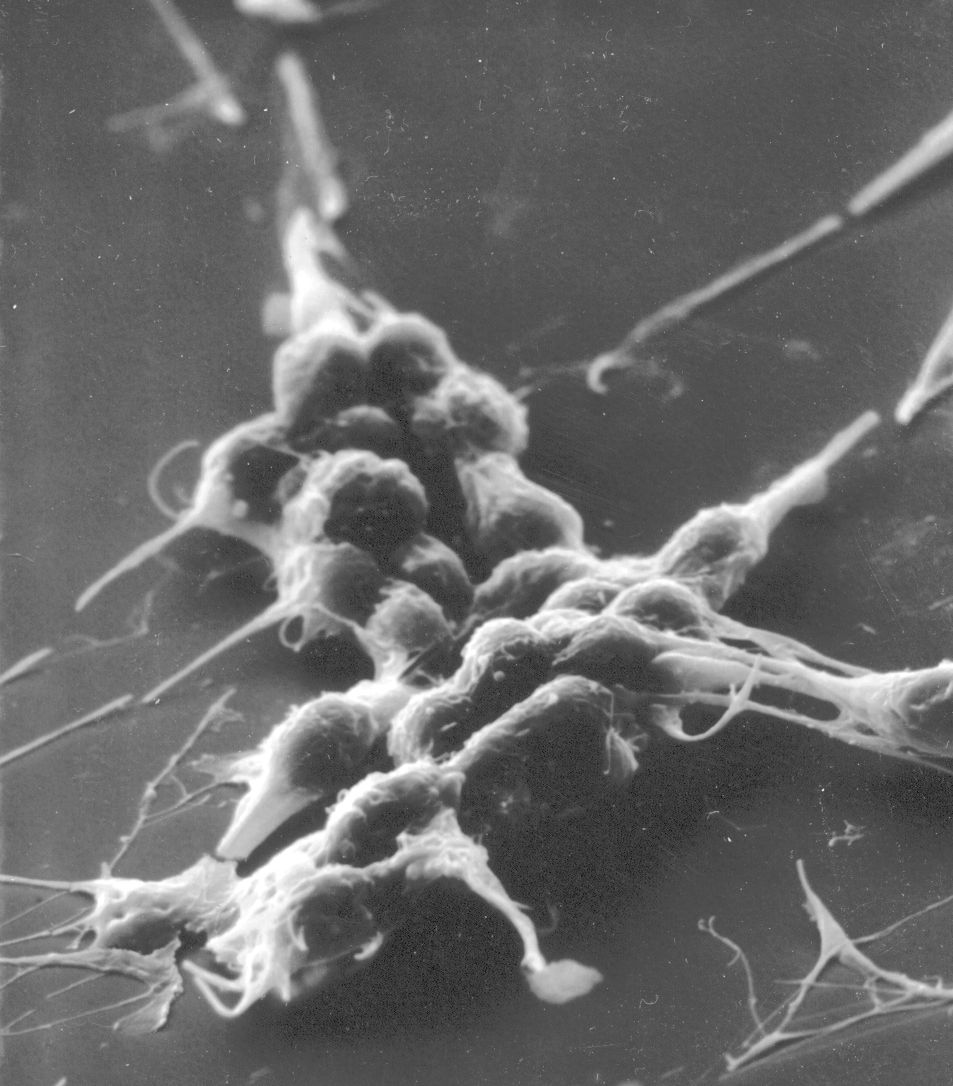 Twee eiwitten bepalen hoe lang bloedplaatjes leven - NRC