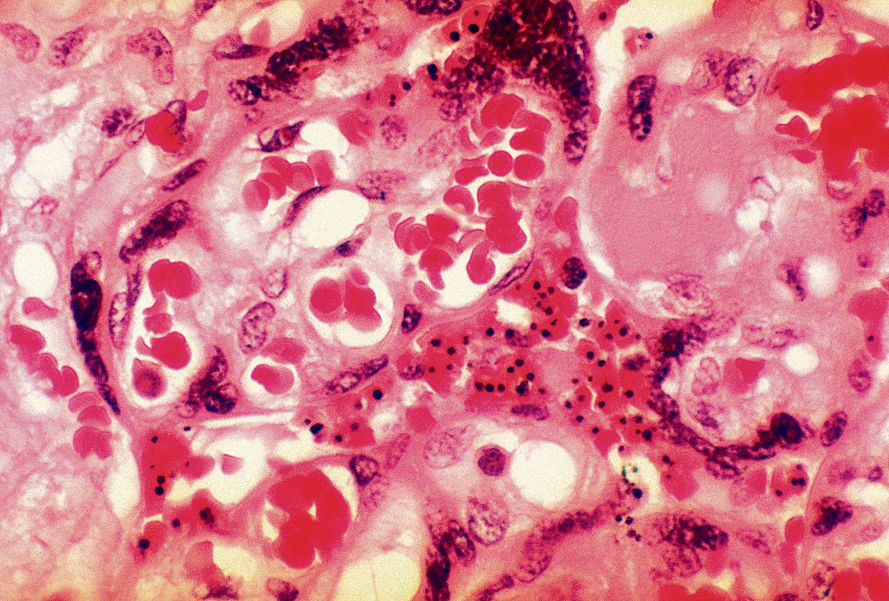 Linke soep voor een parasiet - NRC