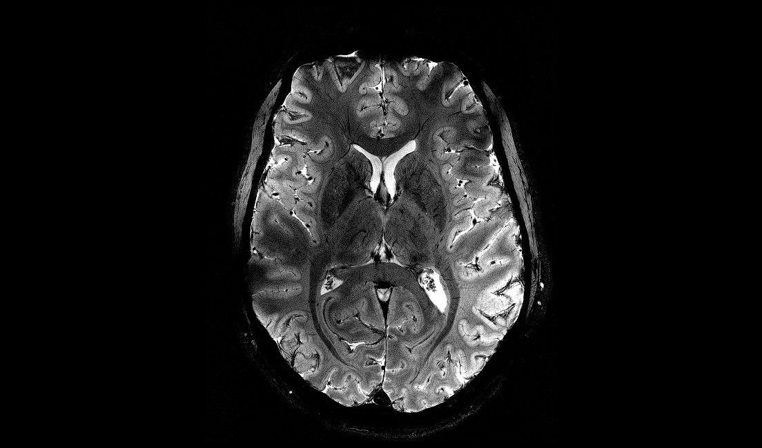 Ongekend scherp beeld van de hersenen uit een Franse MRI-scanner - NRC