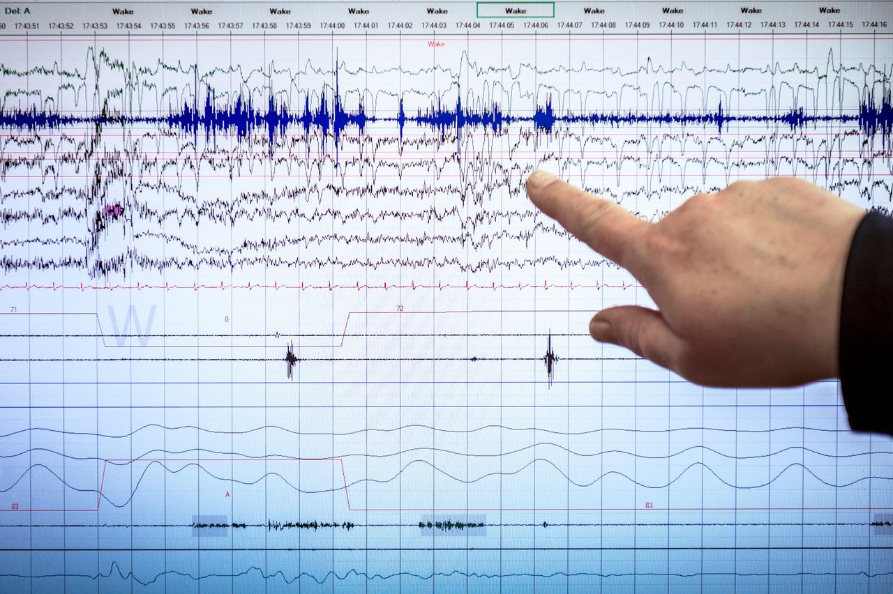 Twijfel over het effect van een behandeling? Dan uit het basispakket - NRC